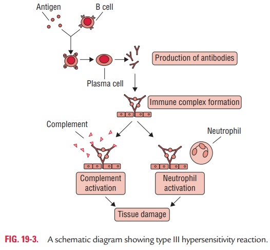 Insecto Alienaci n Parcialidad Serum Sickness Mechanism Est tico Insecto Alienaci n Parcialidad Serum Sickness Mechanism Est tico