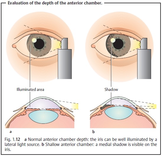 Glaucoma Examination Methods Glaucoma Examination Methods